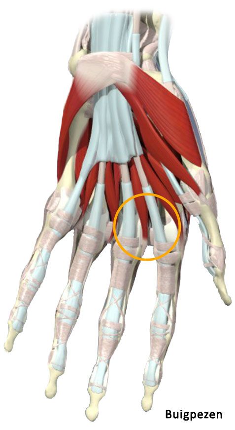 Triggerfinger - Medisch Centrum Waalre